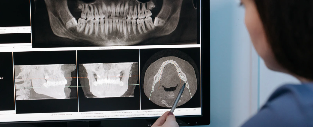 Centro Radiológico Dental: gran aliado en la odontología digital - SOi ...